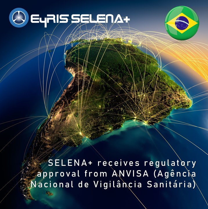 EyRIS - Transforming AI Vision into Reality