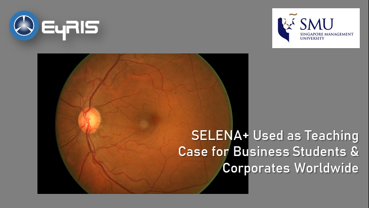 EyRIS - Transforming AI Vision into Reality